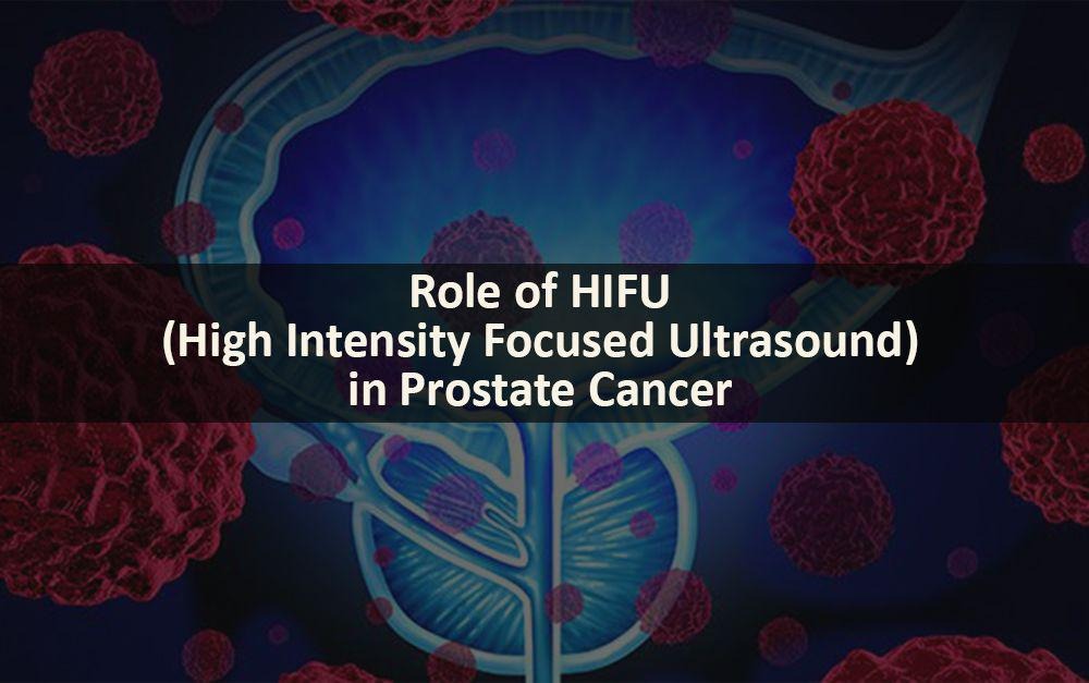 HIFU treatment in India for prostate cancer - Hospital, Doctor